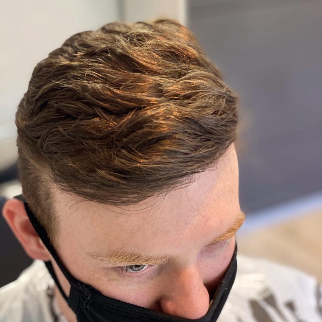 Men's Hair Replacement Bramhall | Hair Rejuvenation UK